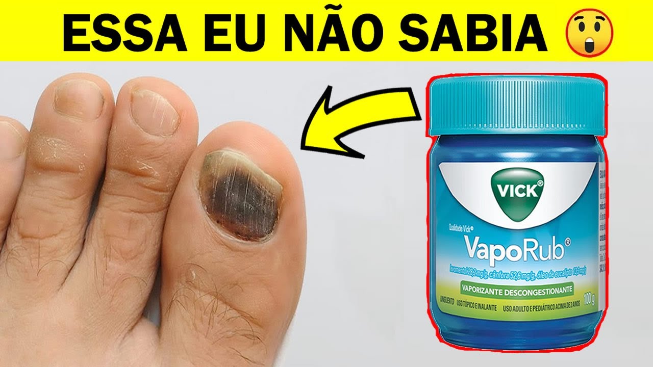10 Usos Do Vick Vaporub Que VocÊ Nem Sabia Porque NÃo Fiz Isso Antes