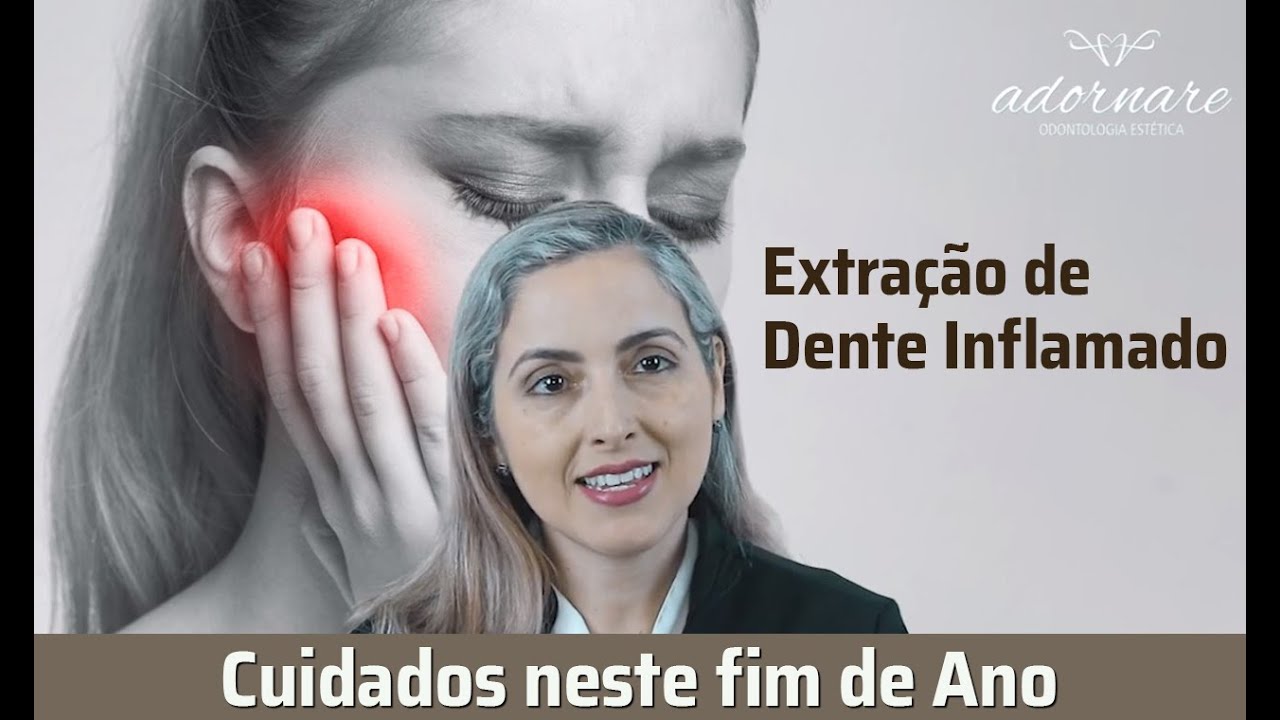 Extração de Dente Inflamado - Como Devemos Proceder - Dicas de Saúde Bucal