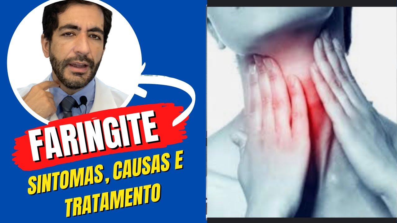 FARINGITE: Causas, sintomas, como evitar e aumentar a imunidade para ...