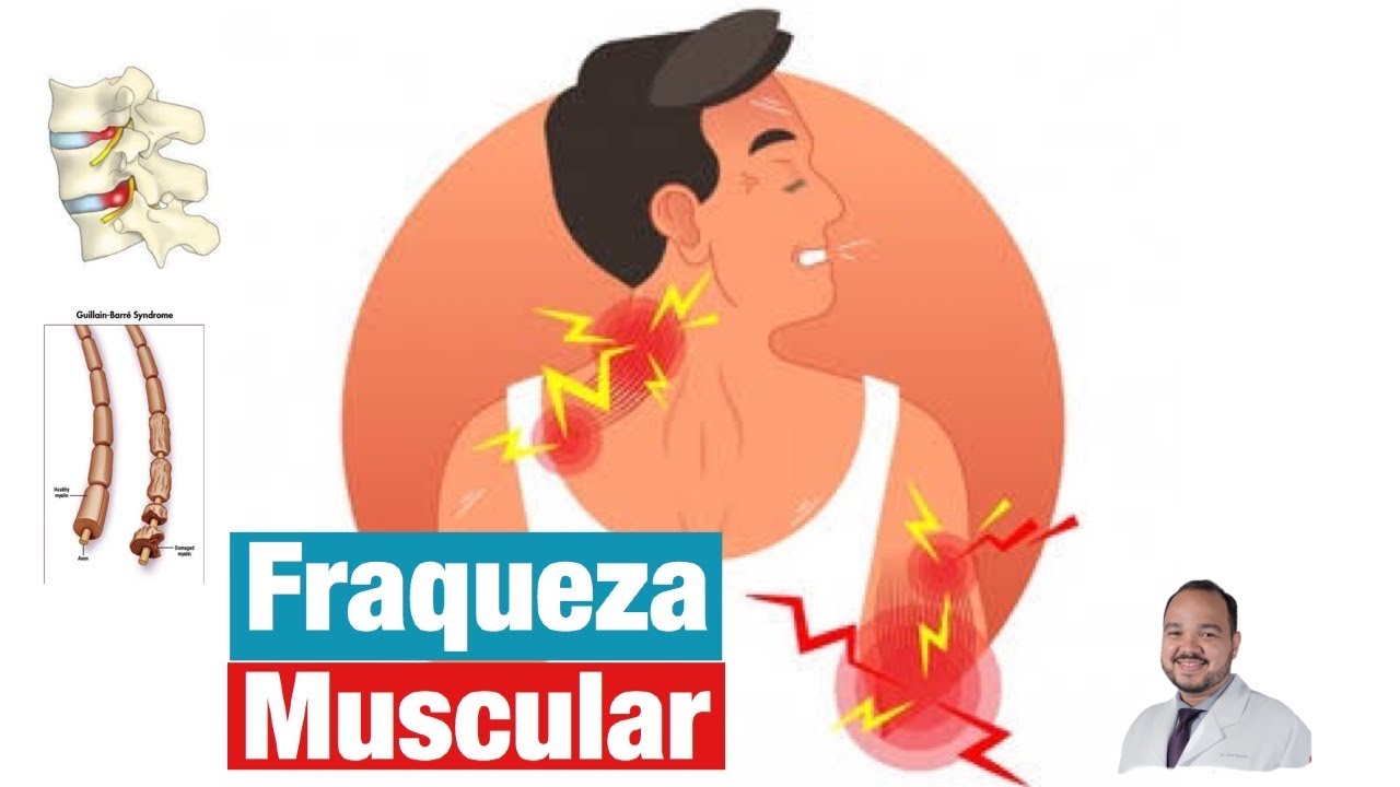 Fraqueza Muscular Crônica: O que pode causar