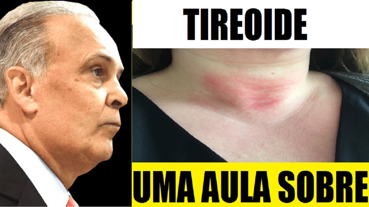 UMA AULA SOBRE TIREOIDE E DOENÇAS QUE ACOMETEM A TIREOIDE | DR LAIR RIBEIRO