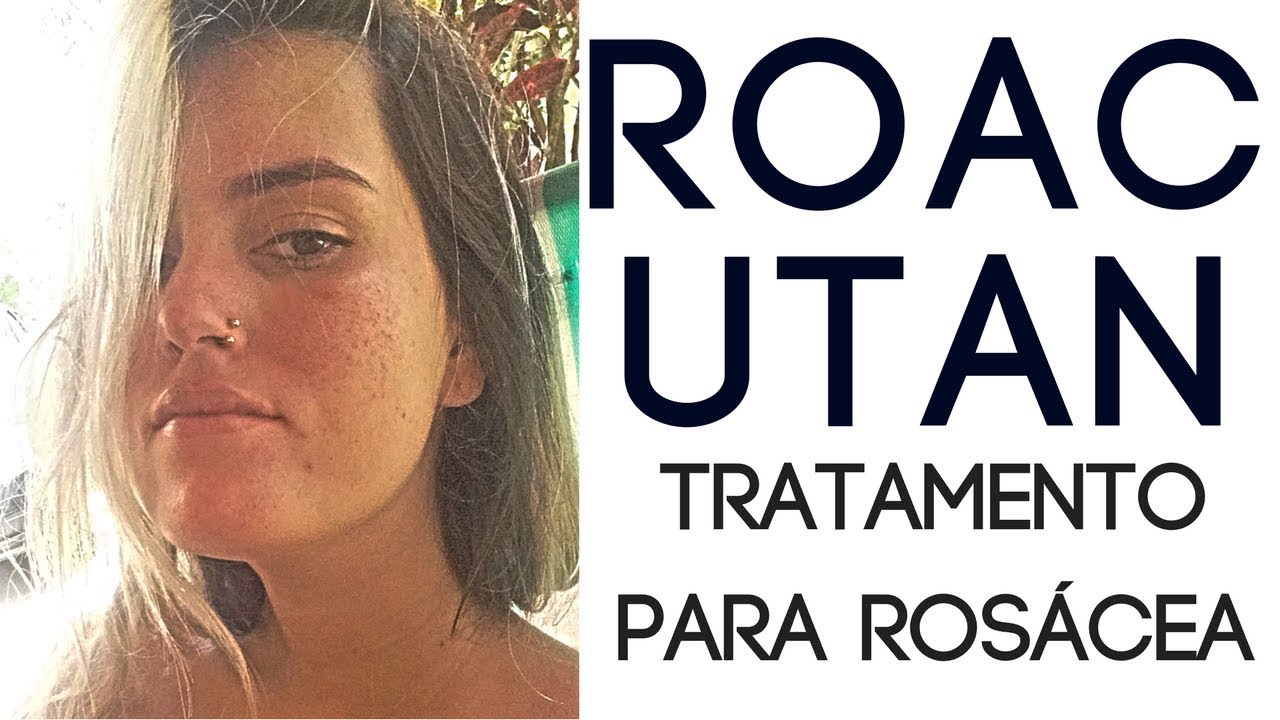 Roacutan para tratar rosácea