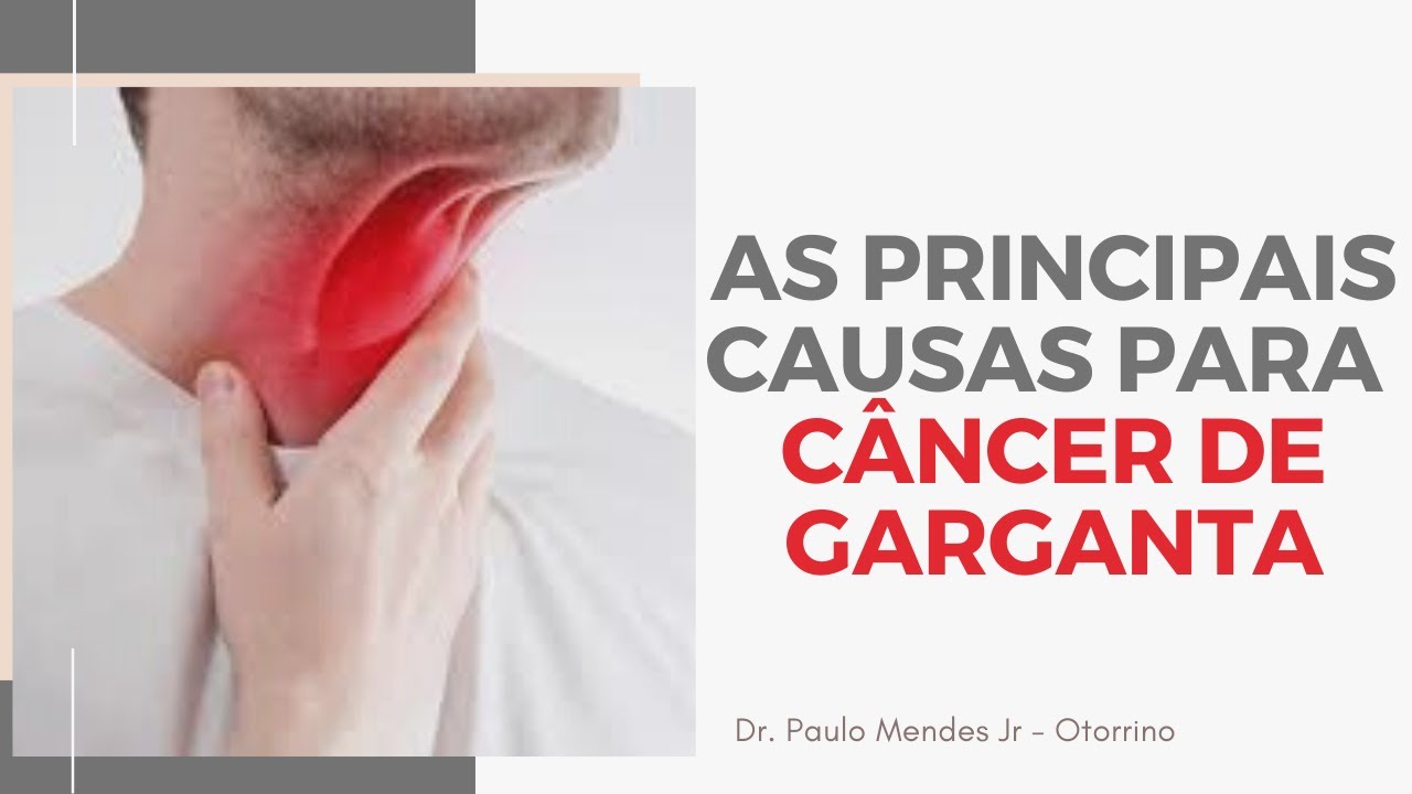 Câncer de Garganta: 4 Sinais de Alerta para Suspeitar da Doença
