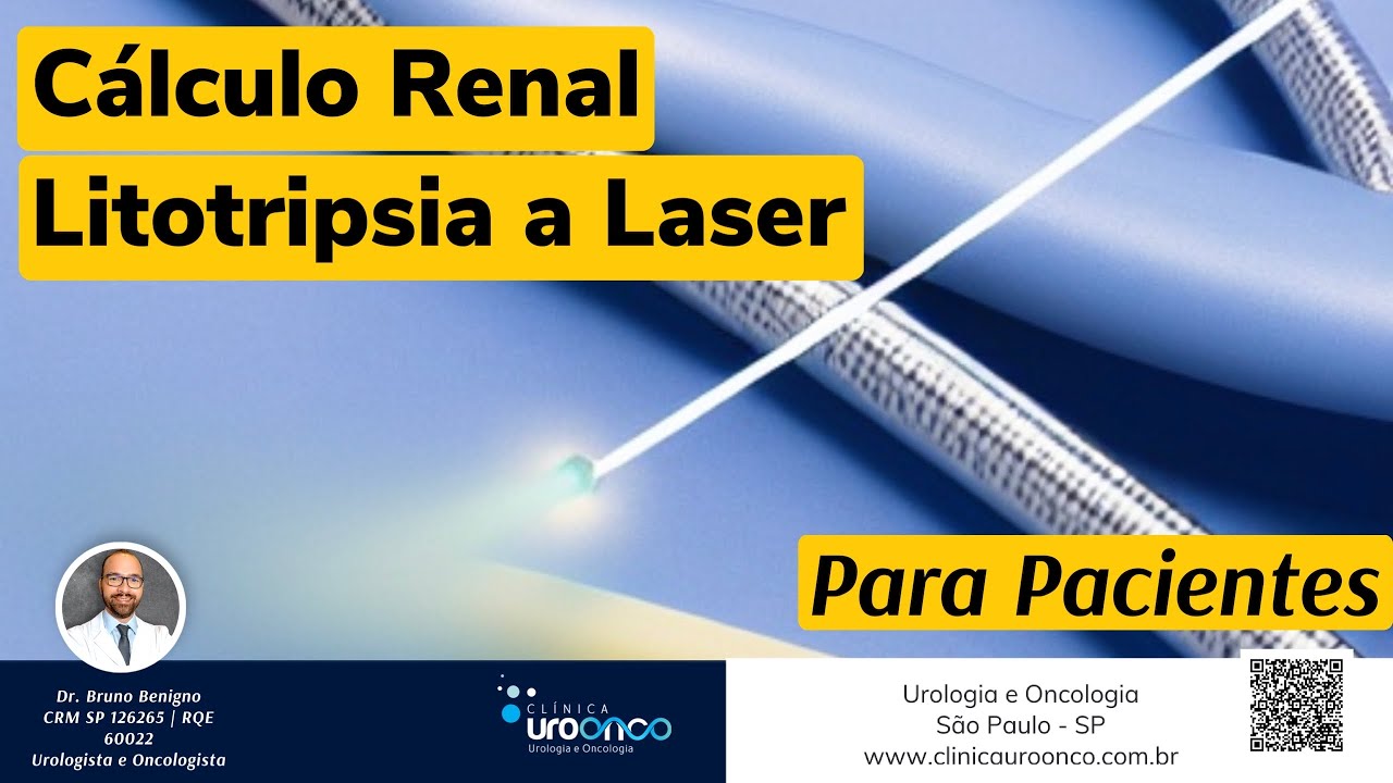 Cirurgia de Pedras nos Rins Utilizando a Técnica de Litotripsia