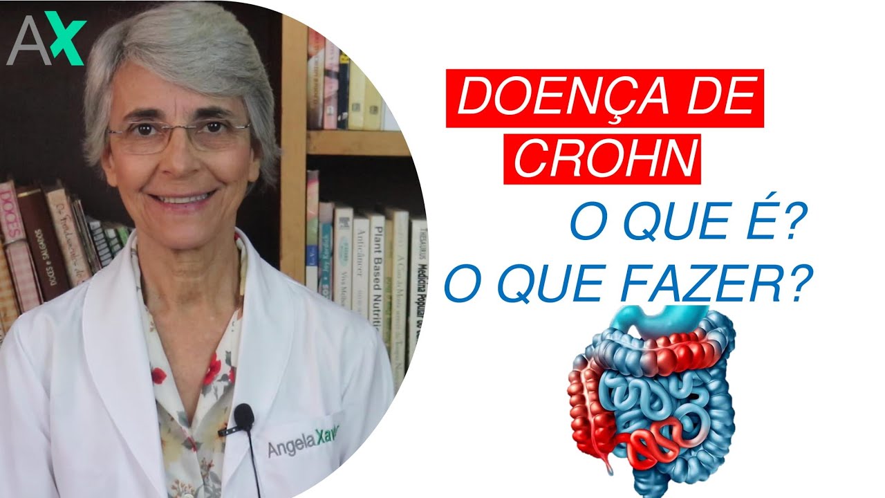 Doença de Crohn: causas, sintomas e tratamentos recomendados.