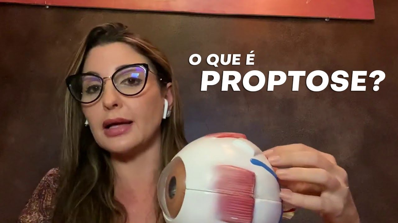 Entenda o que é Proptose ou Exoftalmia e seus sintomas.