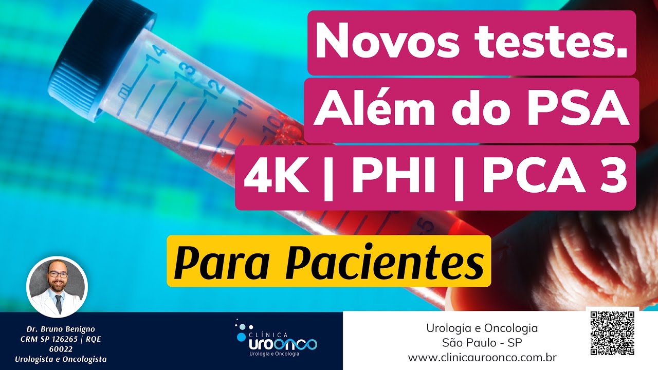 Melhores testes para detecção de câncer de próstata: PHI, 4K e Decipher ...
