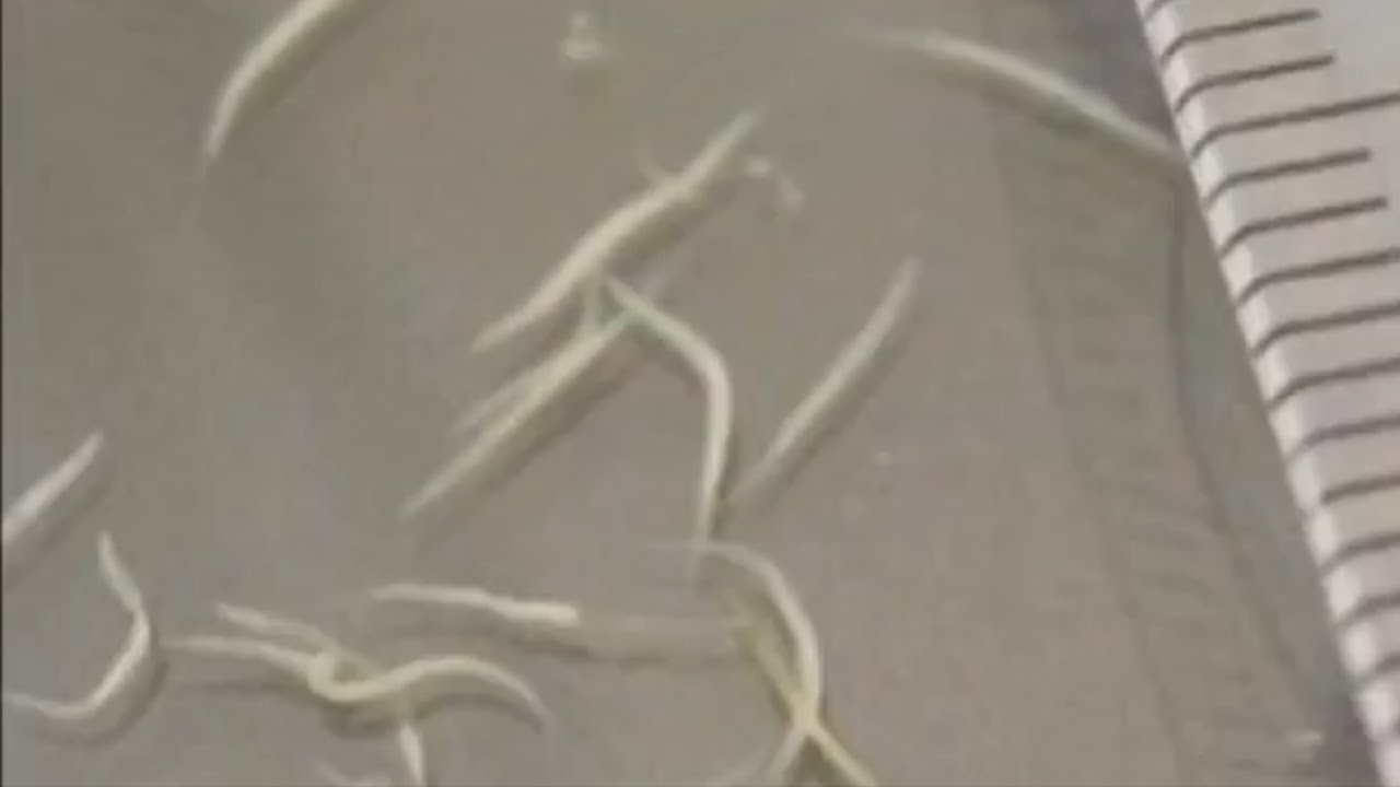 Oxiurose: Entenda o que é e como se prevenir.