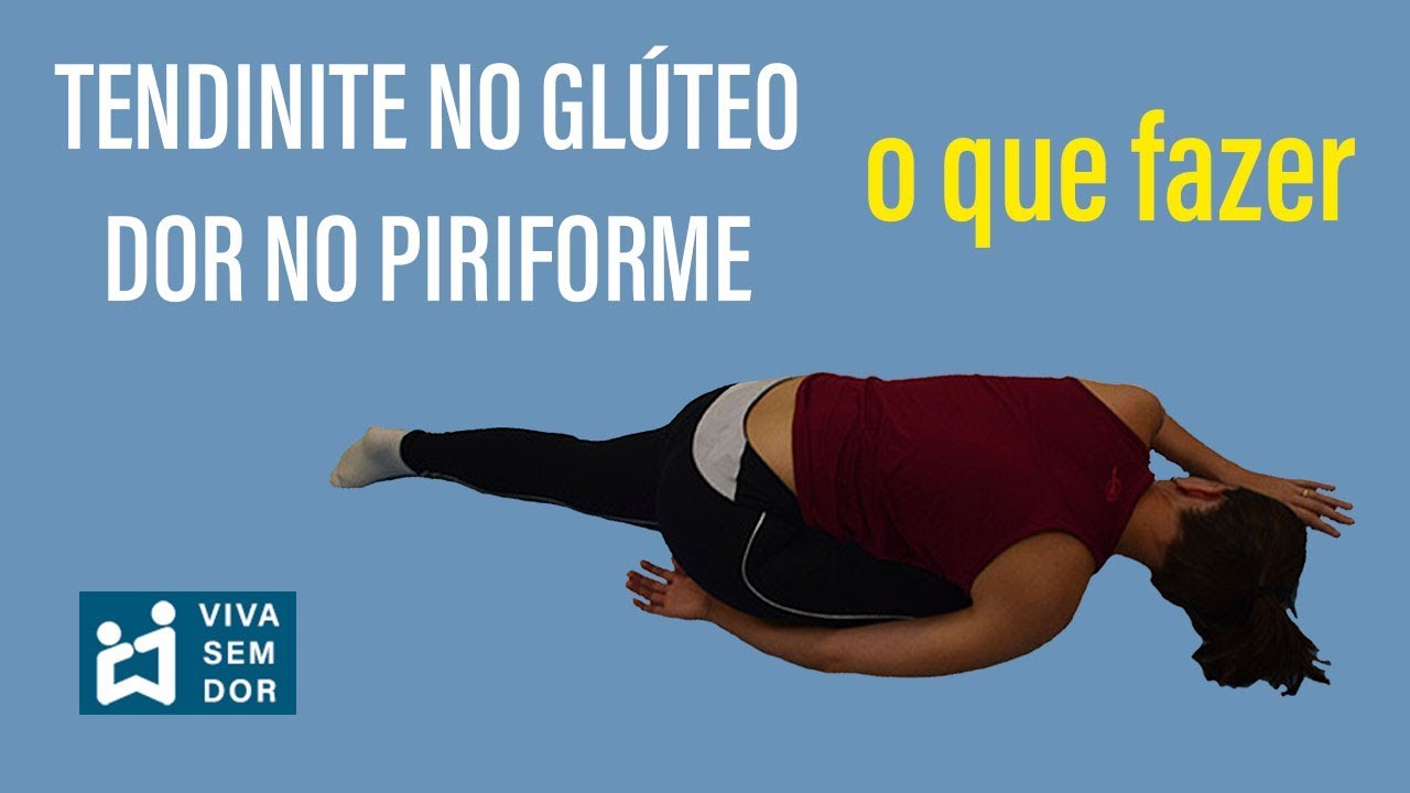 Tendinite e dor no piriforme: causas e tratamentos recomendados