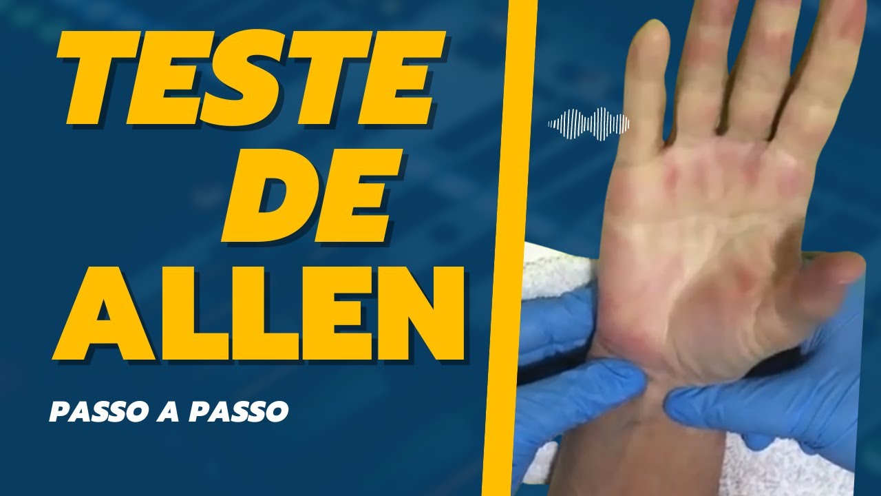 Teste de Allen: Como Realizar Antes da Punção Arterial