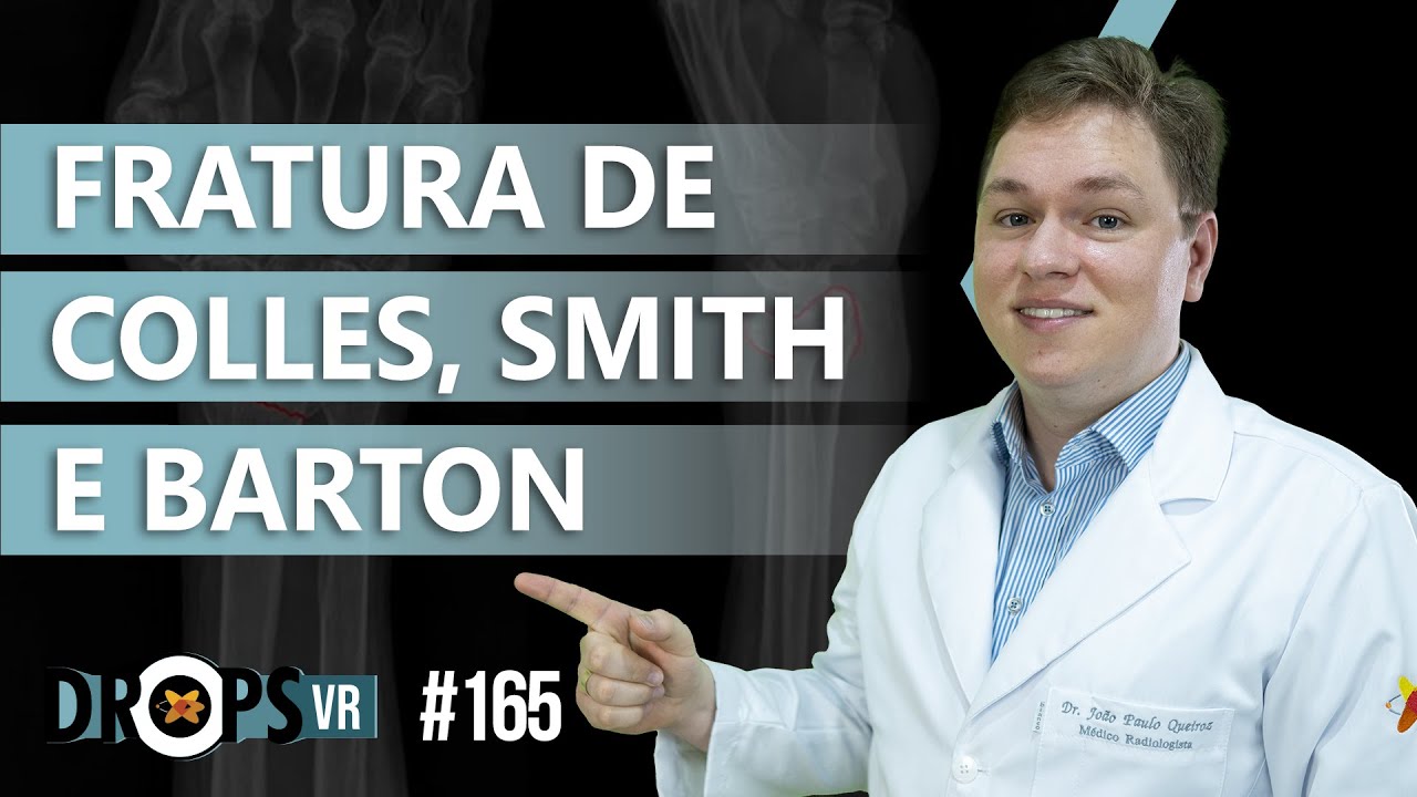 Tipos de fraturas de punho: Colles, Smith e Barton