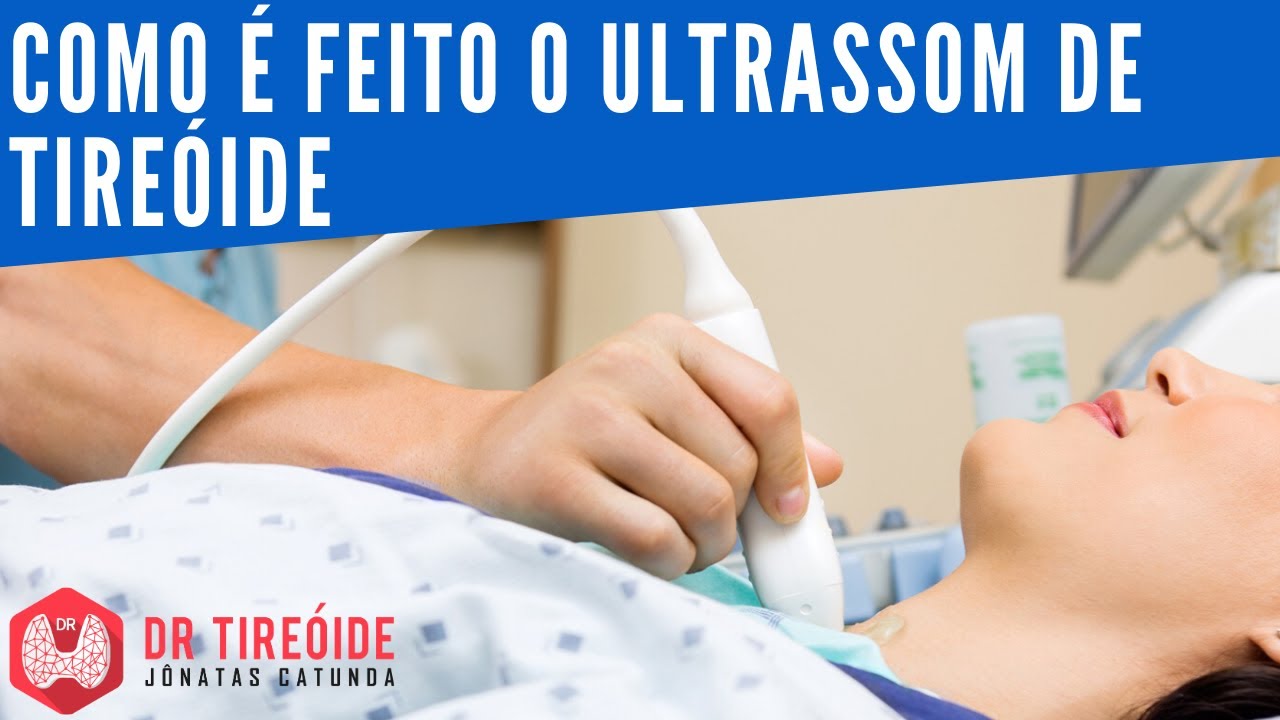 Ultrassom da tireoide: veja como é feito com o Dr. Jônatas Catunda.