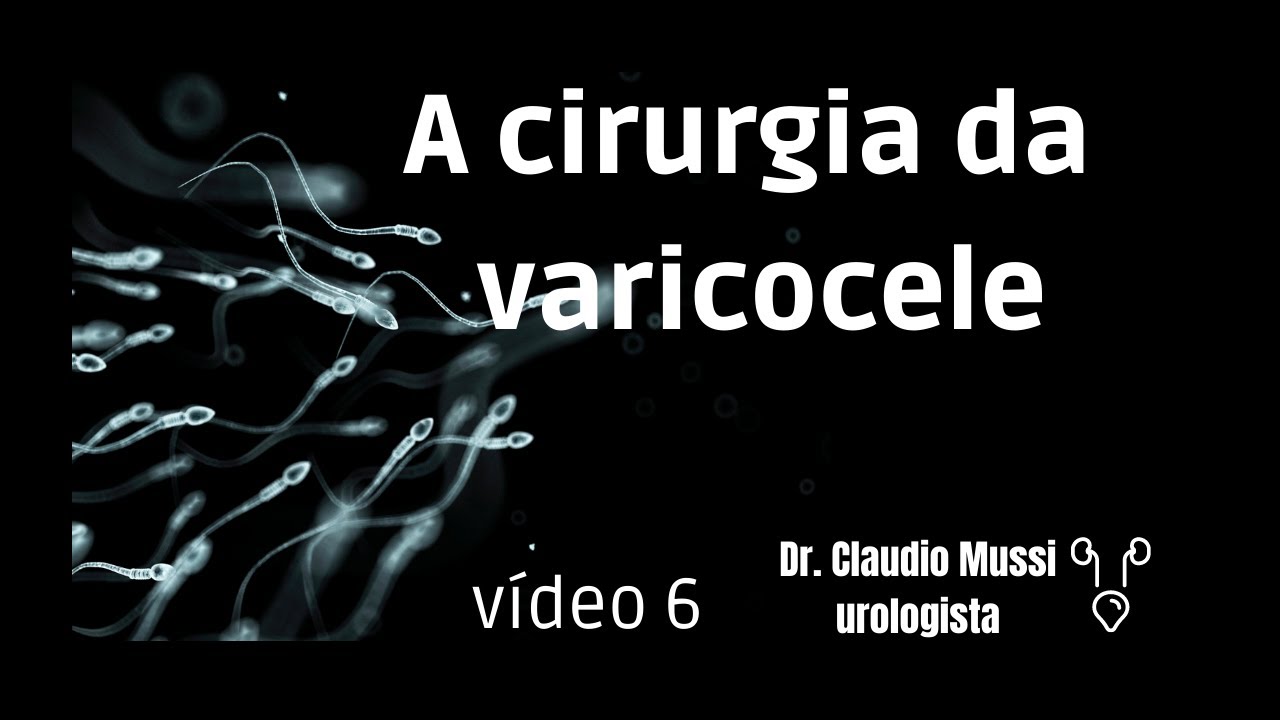 Cirurgia para tratamento da varicocele.