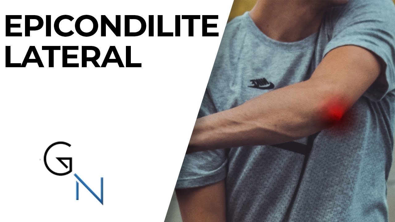 Epicondilite Lateral