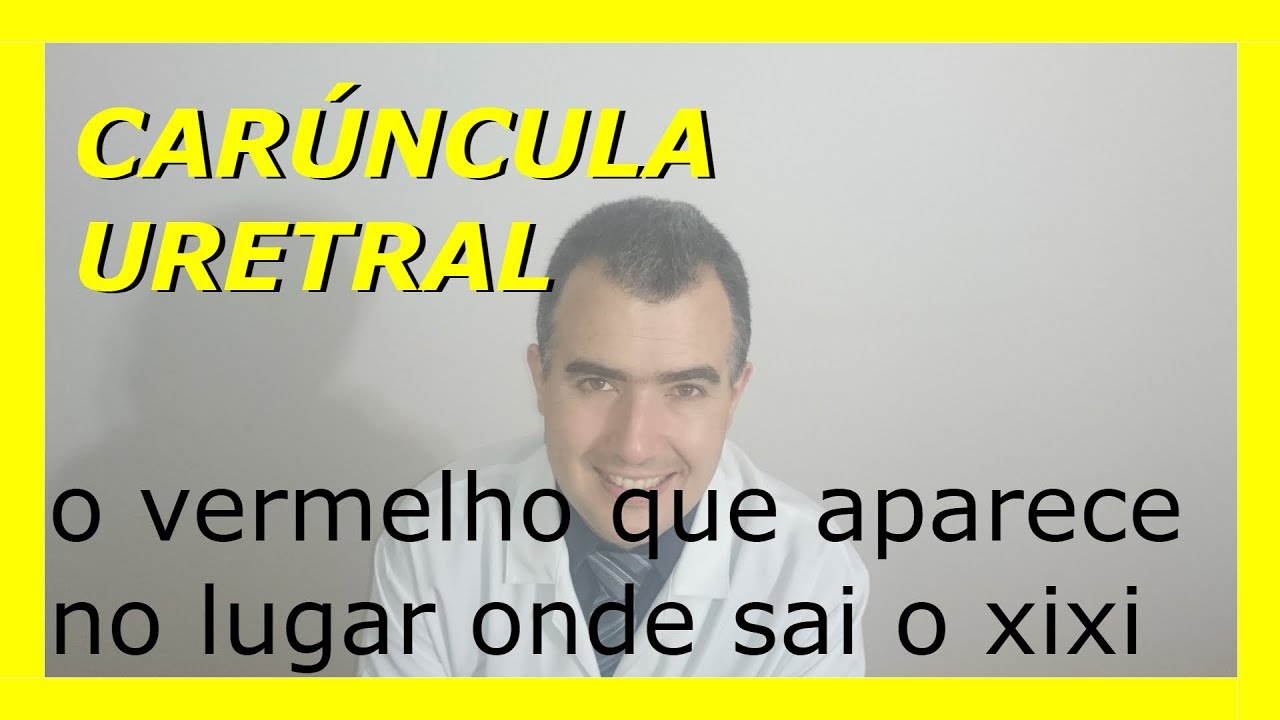 Carúncula uretral: o que é, causas e sintomas