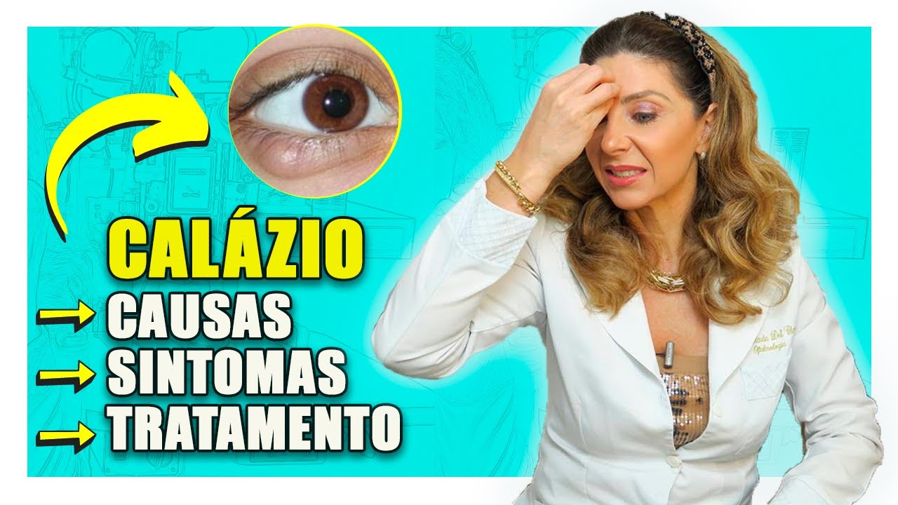 Causas, Sintomas e Tratamento do Calázio: Tudo o que Você Precisa Saber