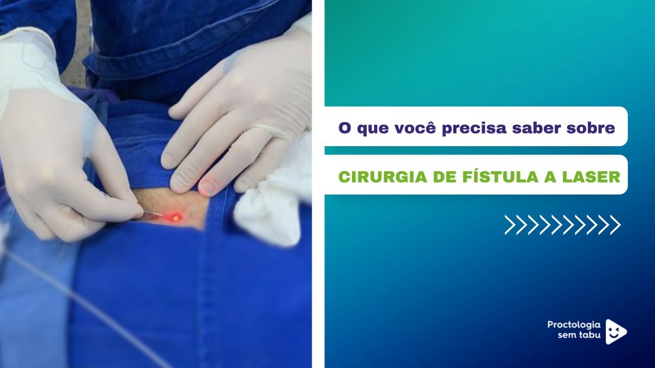 Cirurgia de Fístula a Laser: Tudo o que Você Precisa Saber