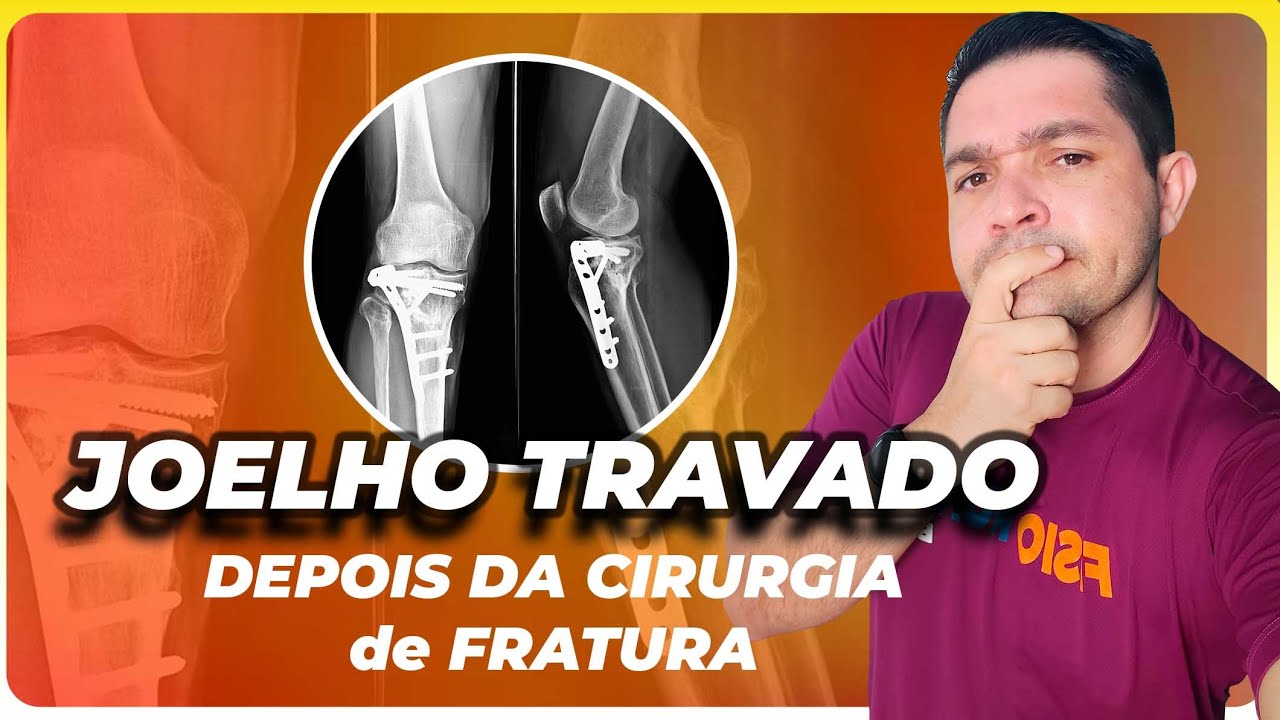 Cirurgia de tíbia: como entender e medir a flexibilidade do joelho com ...