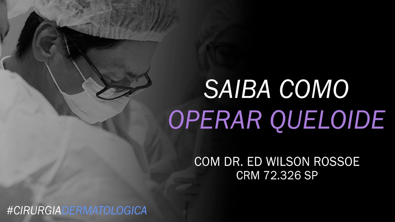 Como Operar Queloide: Guia do Dr. Ed Wilson Rossoe para Cirurgia ...