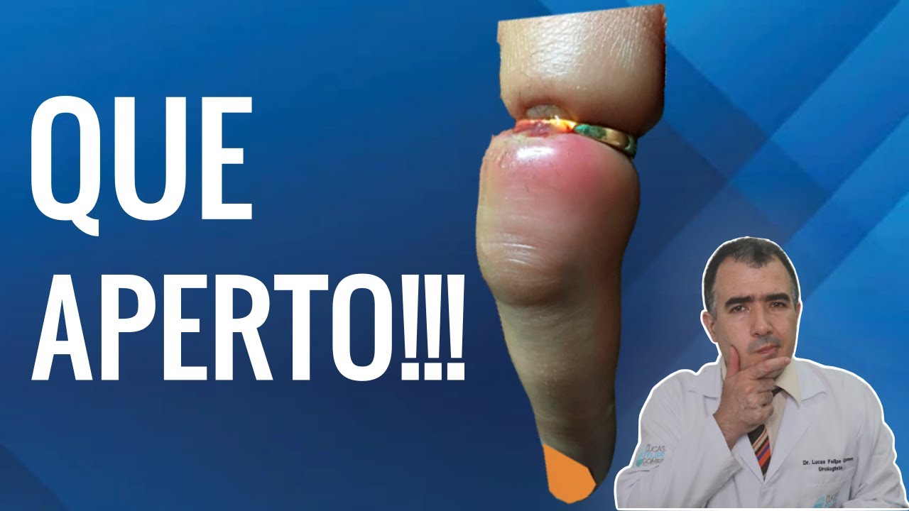 Descubra os principais tratamentos para a Fimose