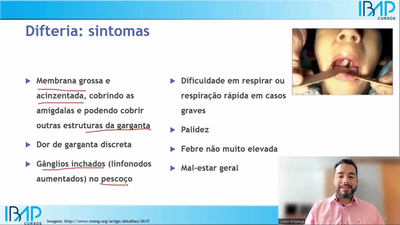 Difteria: causas, sintomas, tratamento e mais