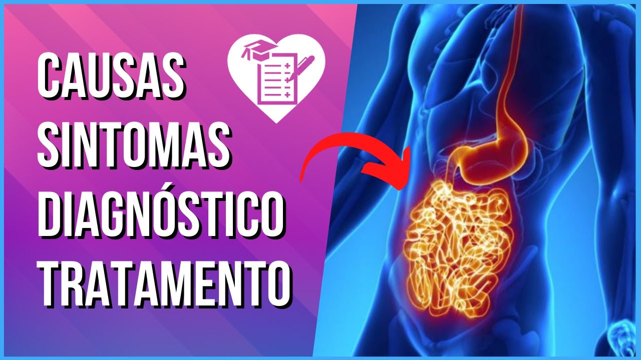 Doença de Crohn: causas, sintomas e tratamento completo