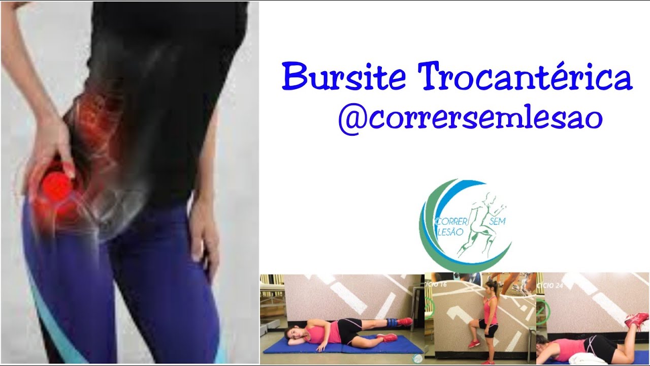 Dor no quadril: Entenda a bursite trocantérica e como tratar