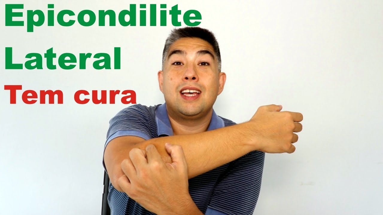Epicondilite Lateral: 5 formas de aliviar a dor no cotovelo de tenista