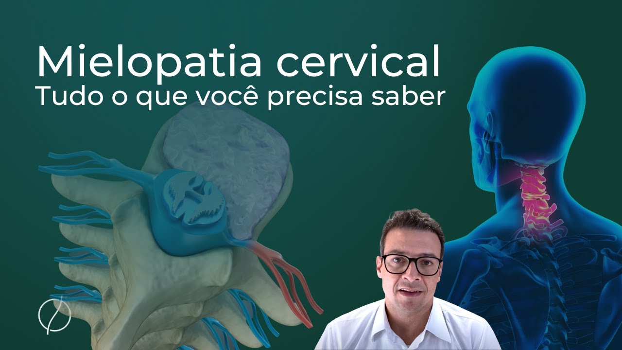 Mielopatia cervical: sintomas, cirurgia e informações essenciais