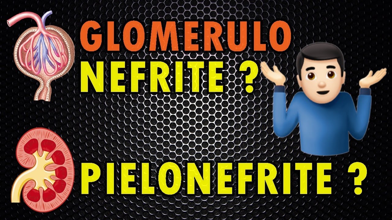 Nefrite vs Pielonefrite: Qual é a diferença?
