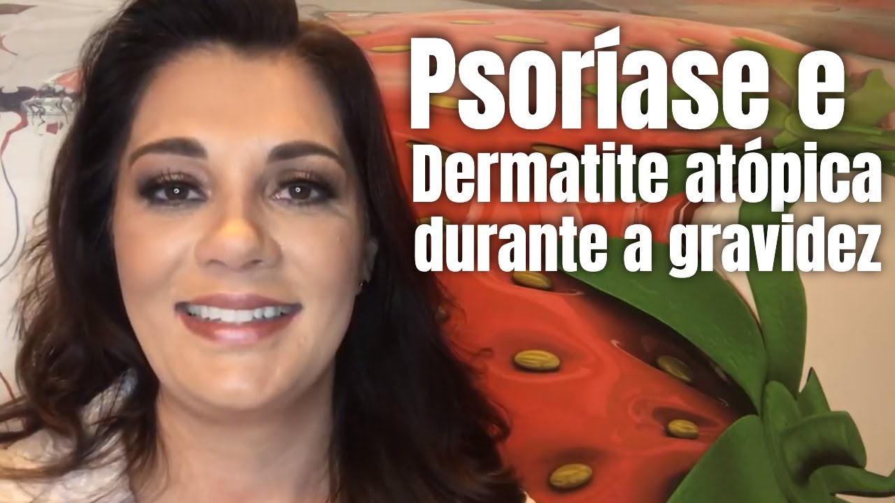 Psor ase E Dermatite At pica Na Gravidez Causas Sintomas E Tratamentos psor-ase-e-dermatite-at-pica-na-gravidez-causas-sintomas-e-tratamentos