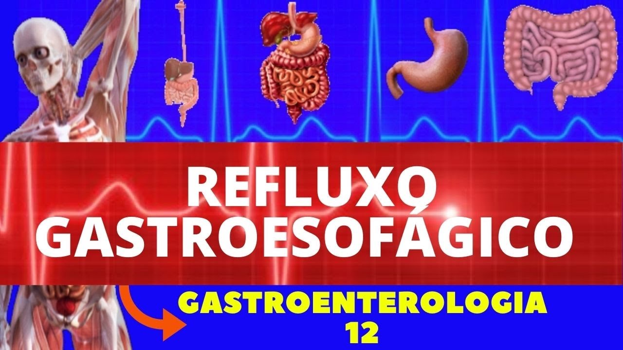Refluxo Gastroesofágico: Causas, Sintomas, Diagnóstico e Tratamento na ...