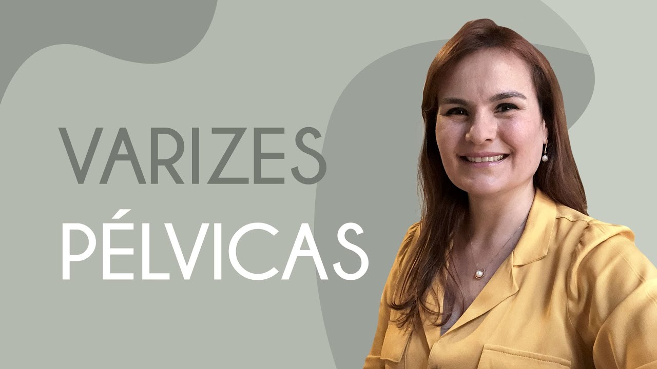 Tratamento de Varizes Pélvicas: Causas, Sintomas, e Opções de Tratamento