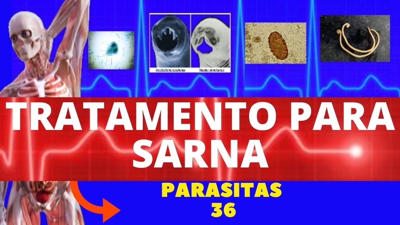 Tratamento eficaz para escabiose humana sarna com Sarcoptes scabiei hominis