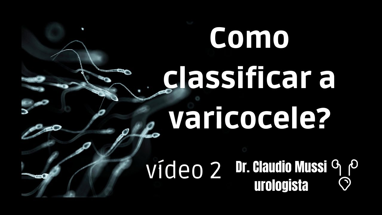 Varicocele: causas, sintomas e tratamentos para diferentes tamanhos