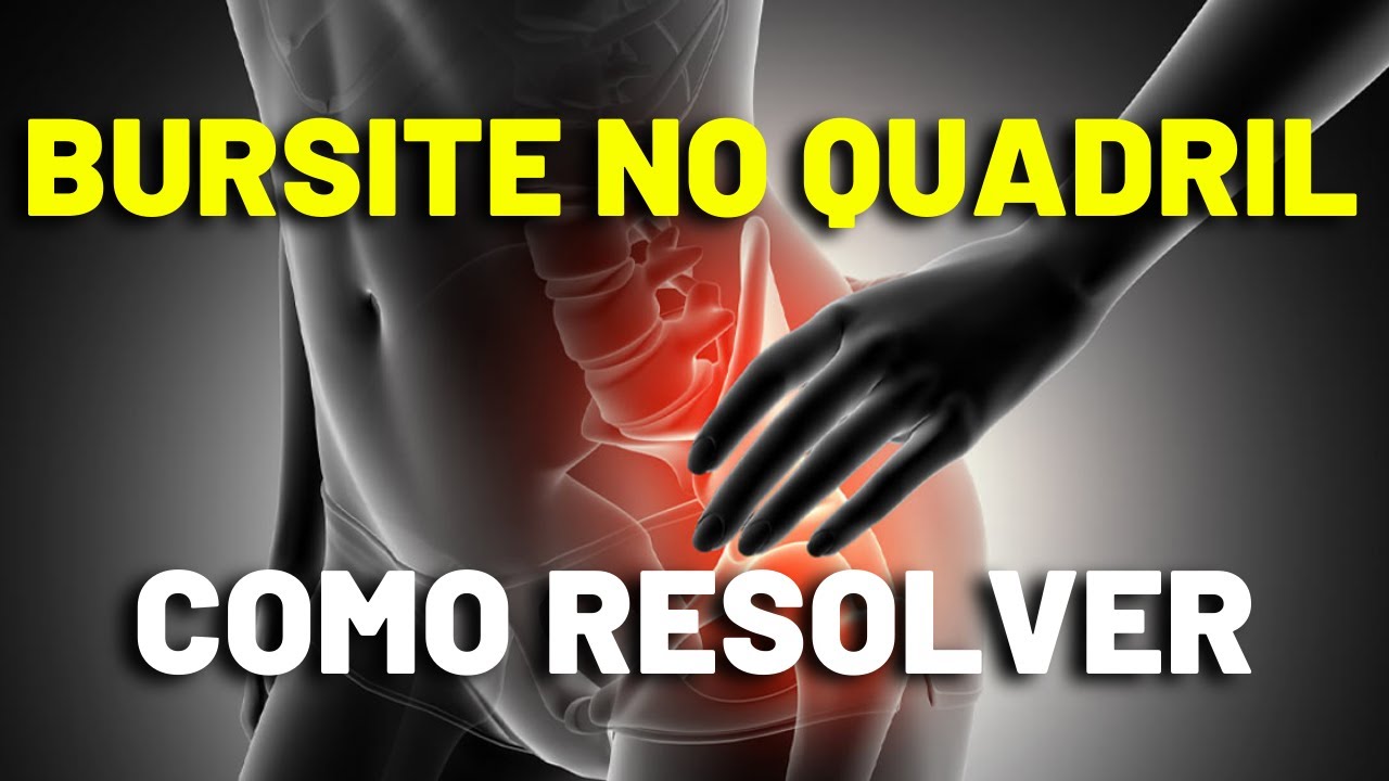 Tratamento para Bursite no Quadril: Dicas e Orientações.