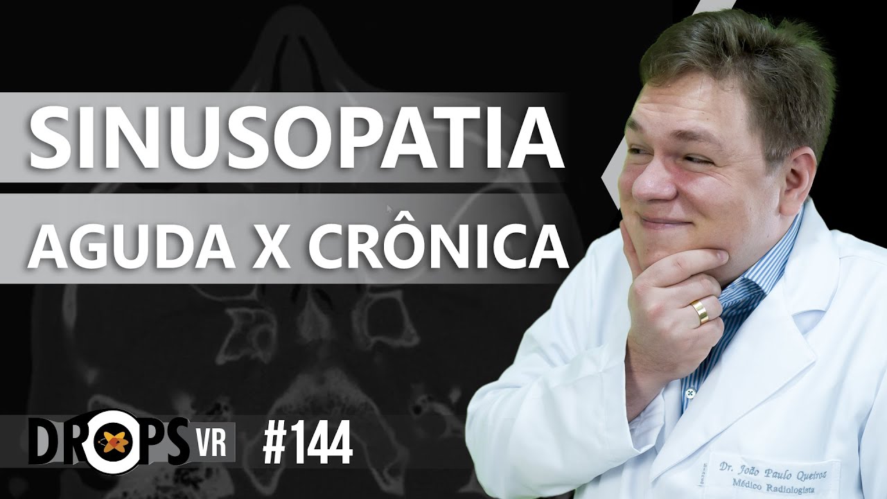 Entenda as diferenças entre sinusopatia aguda e crônica no exame de TC