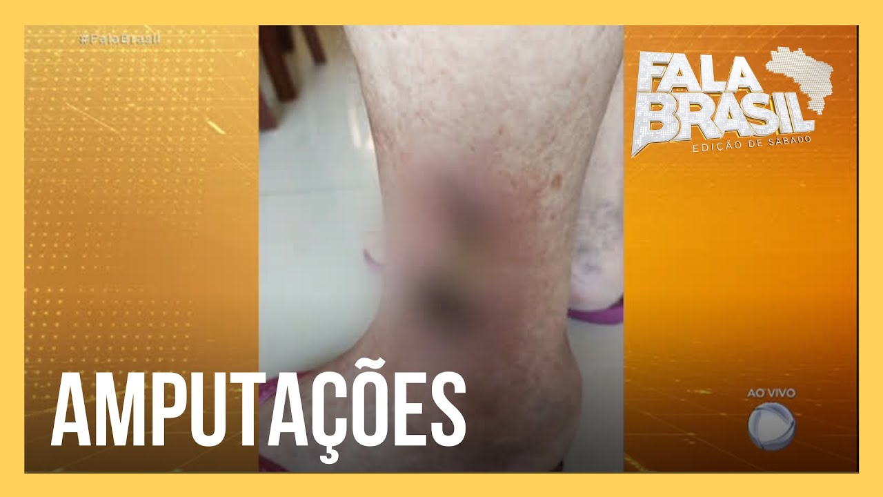 Prevenção De Amputação Em Pacientes Com Diabetes A Importância Do