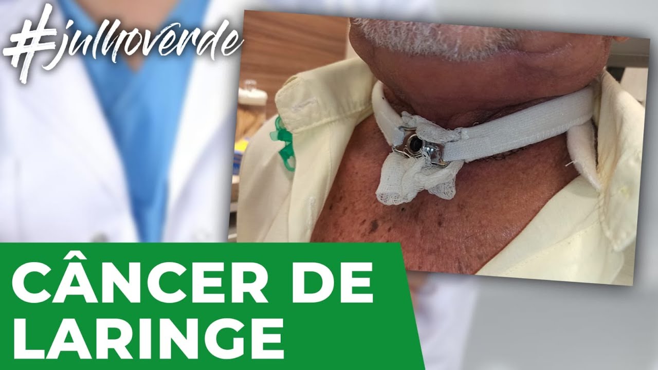 Câncer de laringe: Conheça a campanha Julho Verde para conscientização