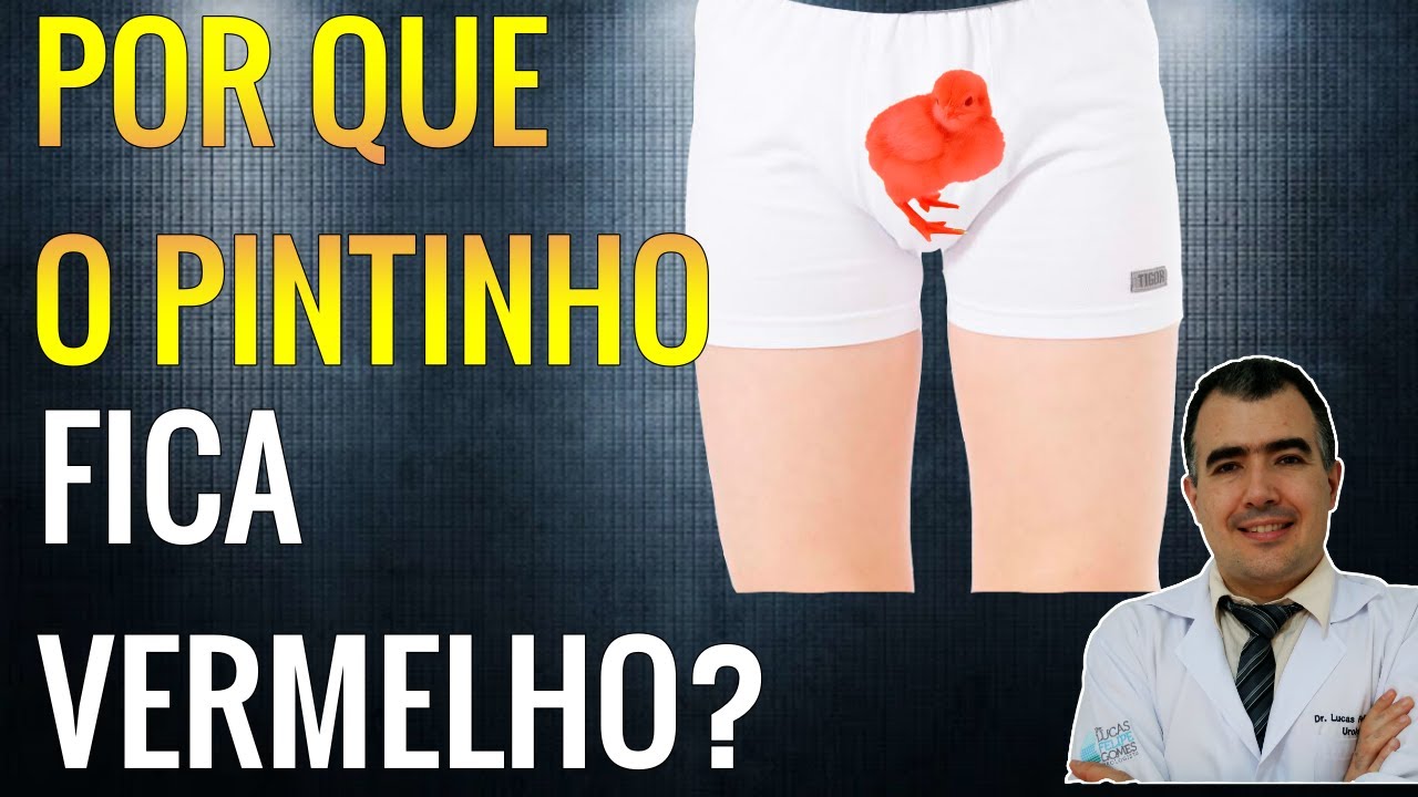 Causas comuns de balanopostites em crianças e adolescentes