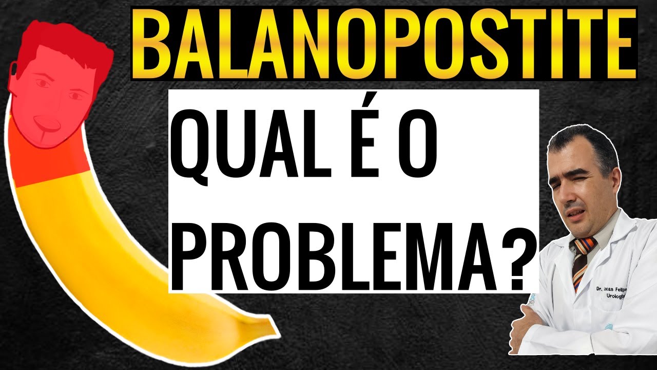 Causas e sintomas da balanopostite: descubra aqui.