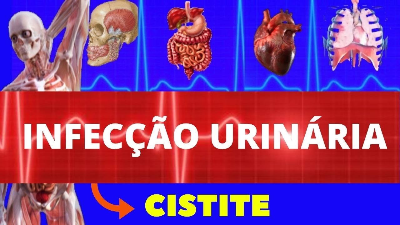 Cistite: sintomas, diagnóstico e tratamento para infecção urinária na ...