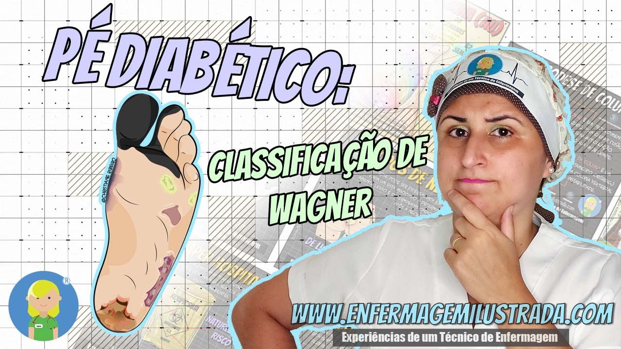 Classificação de Wagner para o Pé Diabético: Entenda mais sobre esse ...
