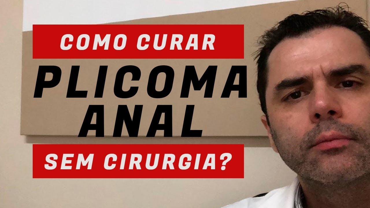 Como tratar o plicoma anal sem cirurgia de forma eficaz