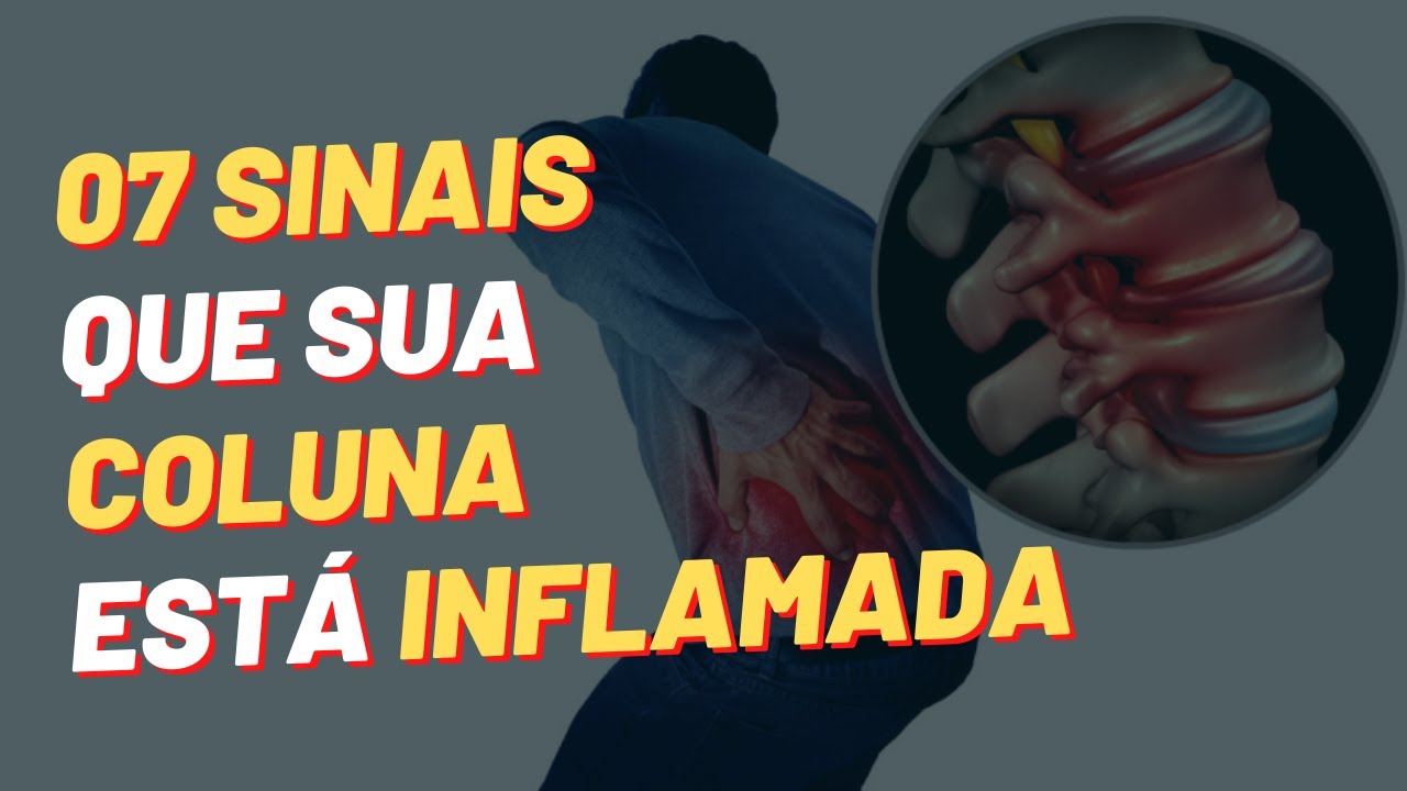 Descubra os sinais de inflamação na coluna: fique por dentro