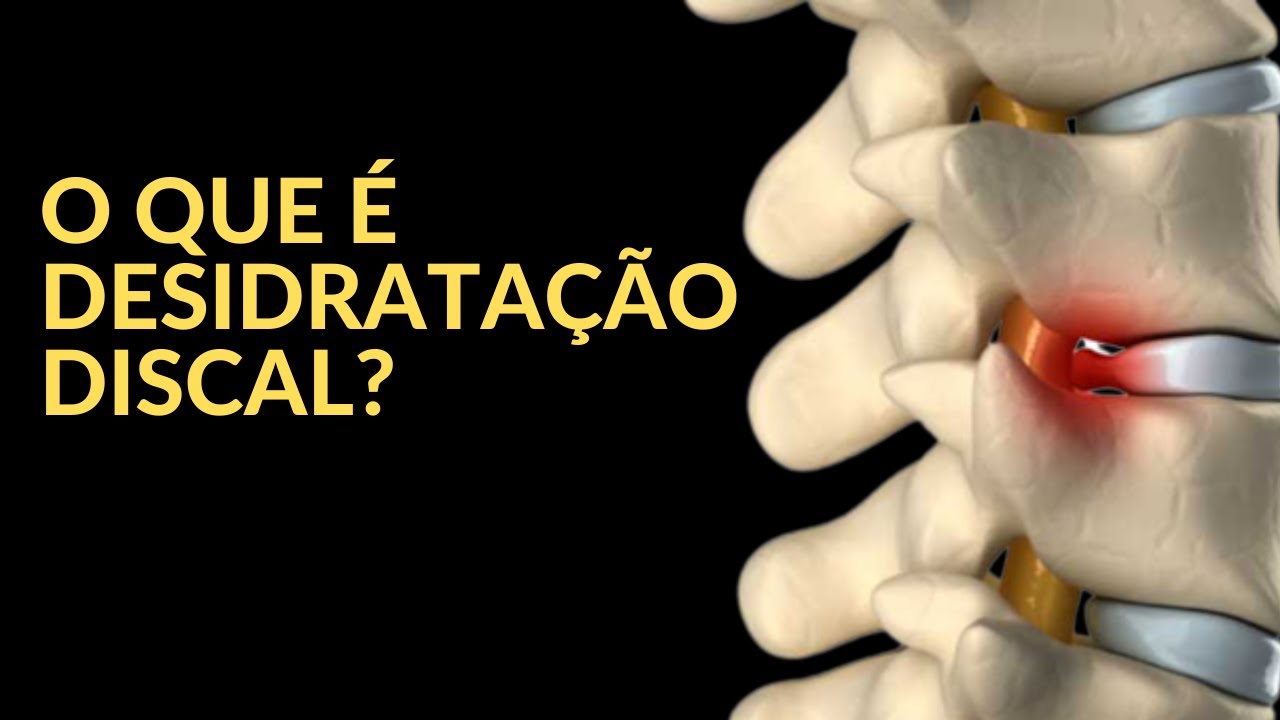 Desidratação Discal L4-l5 E L5-s1 - RETOEDU