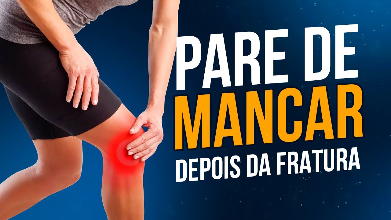 Dicas para parar de mancar após fratura do membro inferior