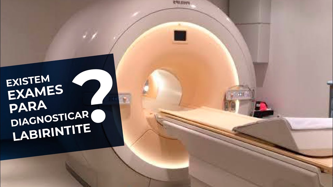 Exames para identificar labirintite e tontura: Neurologista Dr. Saulo ...