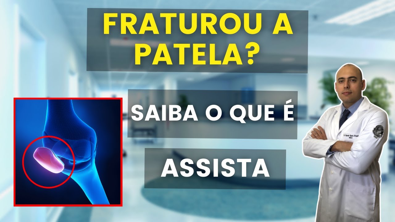 Fratura de patela: Guia completo para pacientes - Explicação clara e ...
