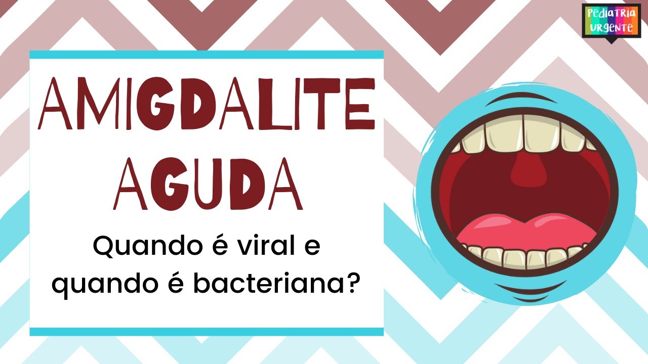 Identificando a amigdalite aguda: viral ou bacteriana - guia para ...